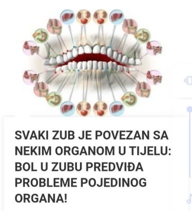 Svaki Zub Je Povezan Sa Nekim Organom U Tijelu: Bol U Zubu Predviđa ...